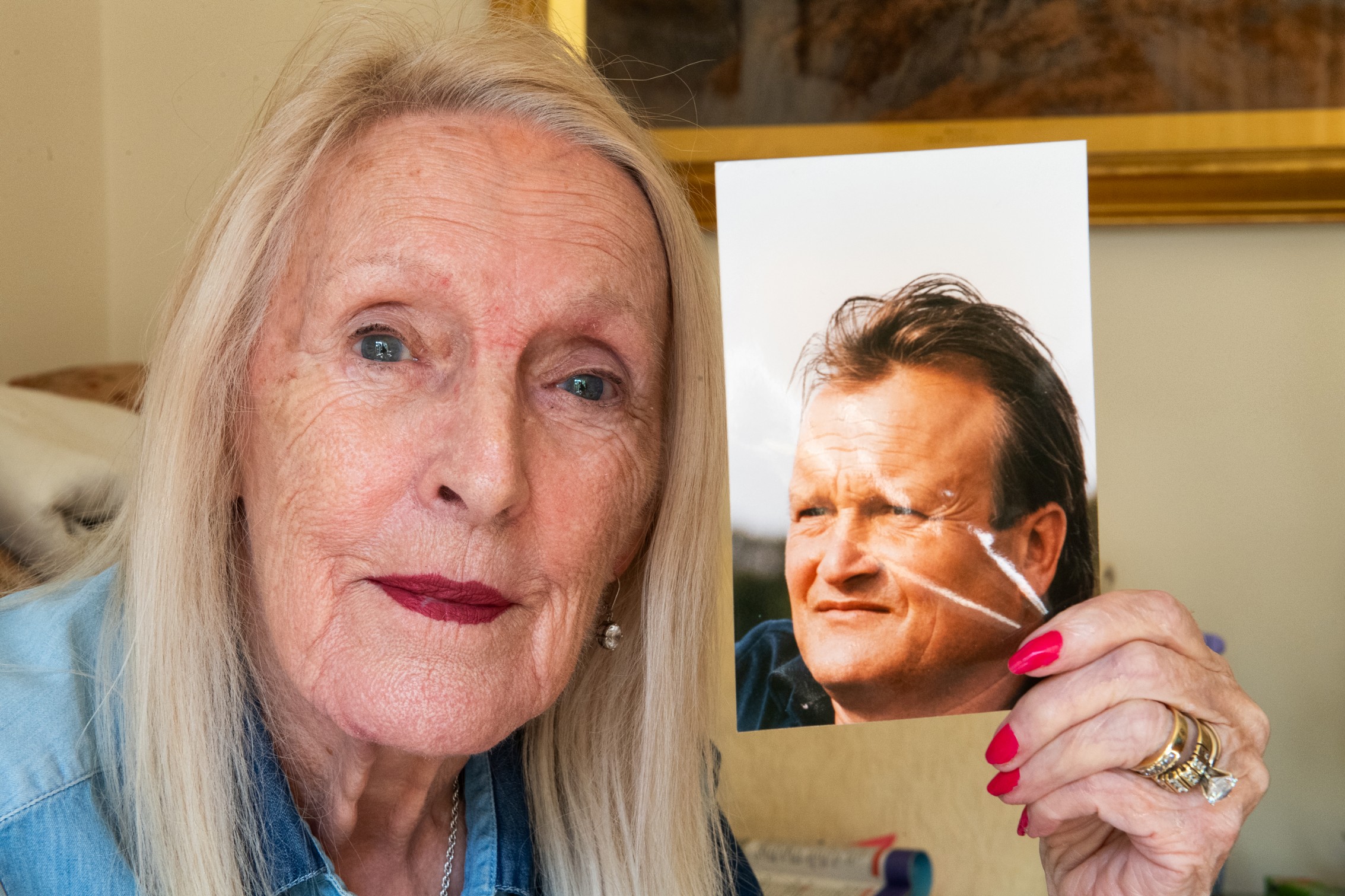 JEP Investigates: "You could see the bone... Eddie's pain must have ...